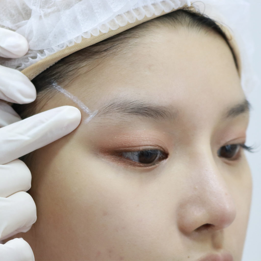 ENDOLINE FOXY EYES – Waleerat Clinic