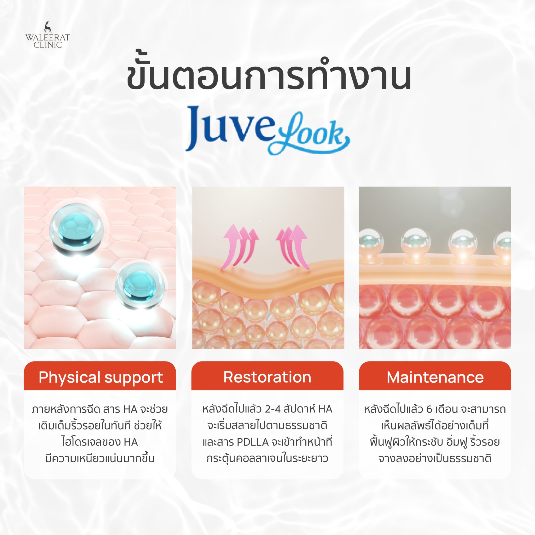 เปิดประสบการณ์ผิวใสด้วย Juvelook ที่ Waleerat Clinic – Waleerat Clinic