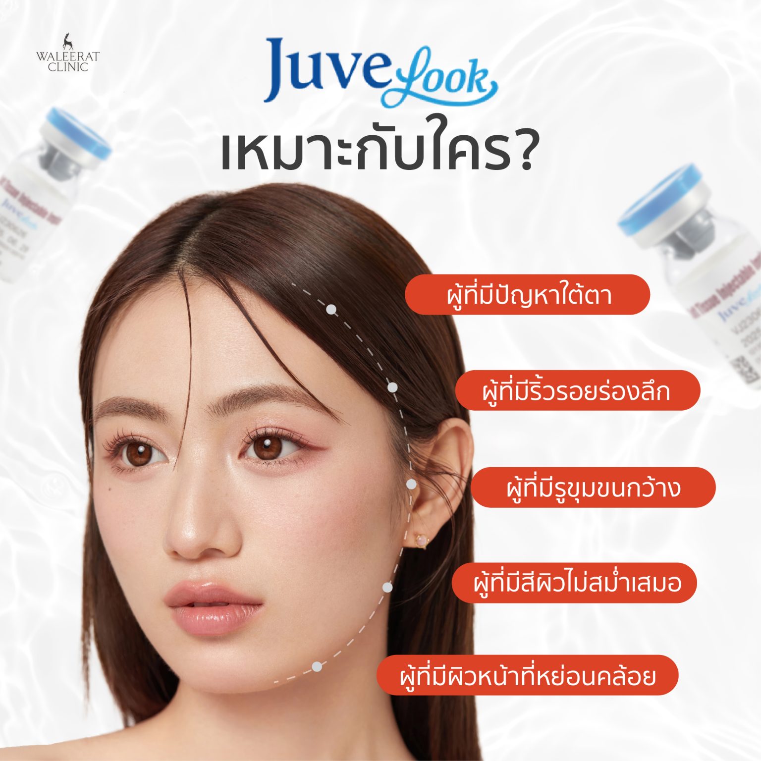 เปิดประสบการณ์ผิวใสด้วย Juvelook ที่ Waleerat Clinic – Waleerat Clinic